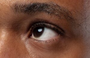 10 Eye Defects - Causes And Correction - KompleteCare Blog